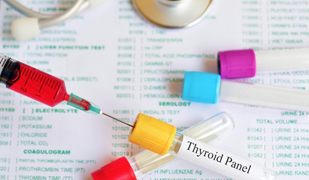 Thyroid Labs Cheat Sheet | Healthful Elements